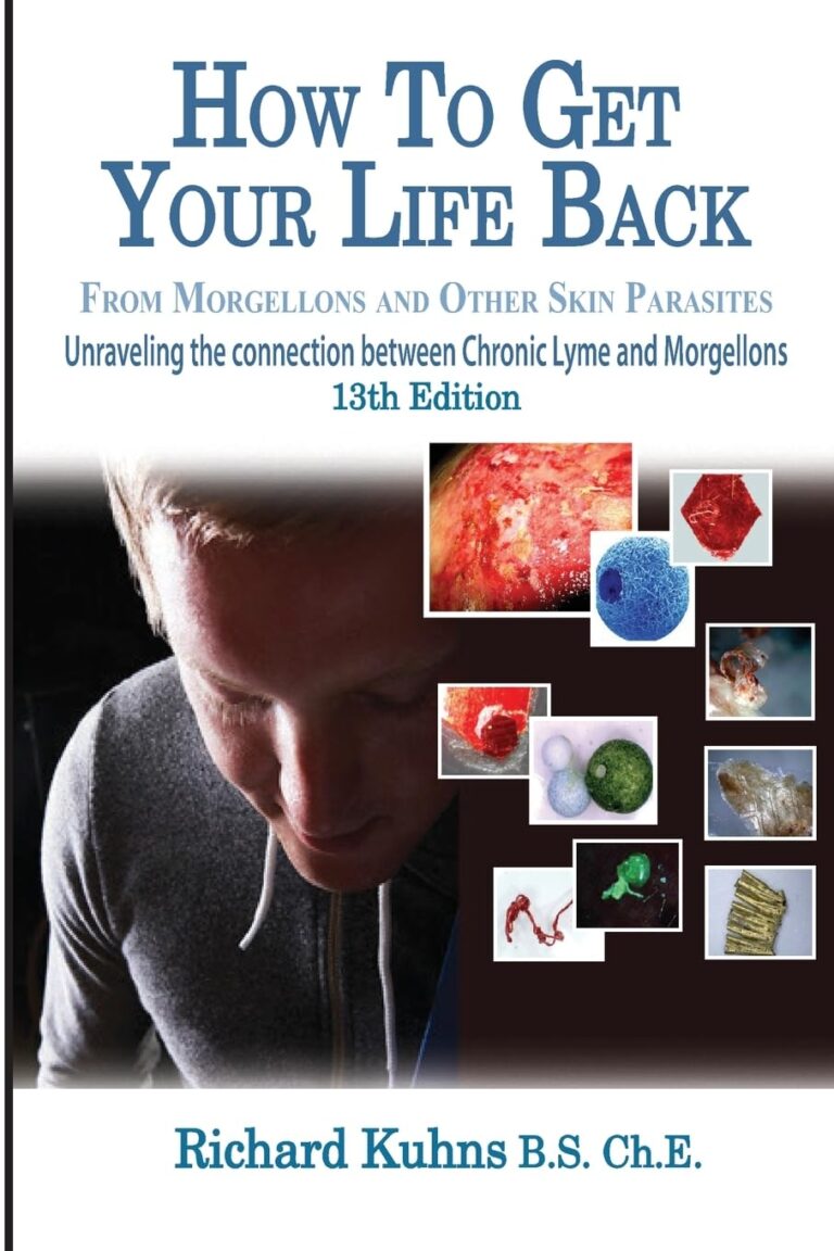 Top 10 Books Linking Parasites and Worms with Human Diseases
